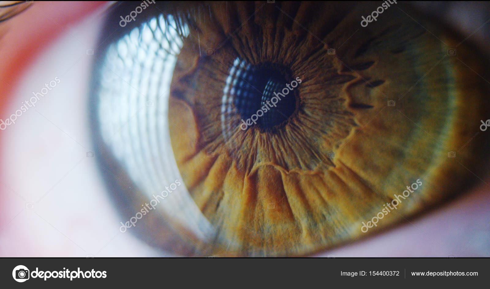 Perfect green eye macro in a sterile environment and perfect vision in ...