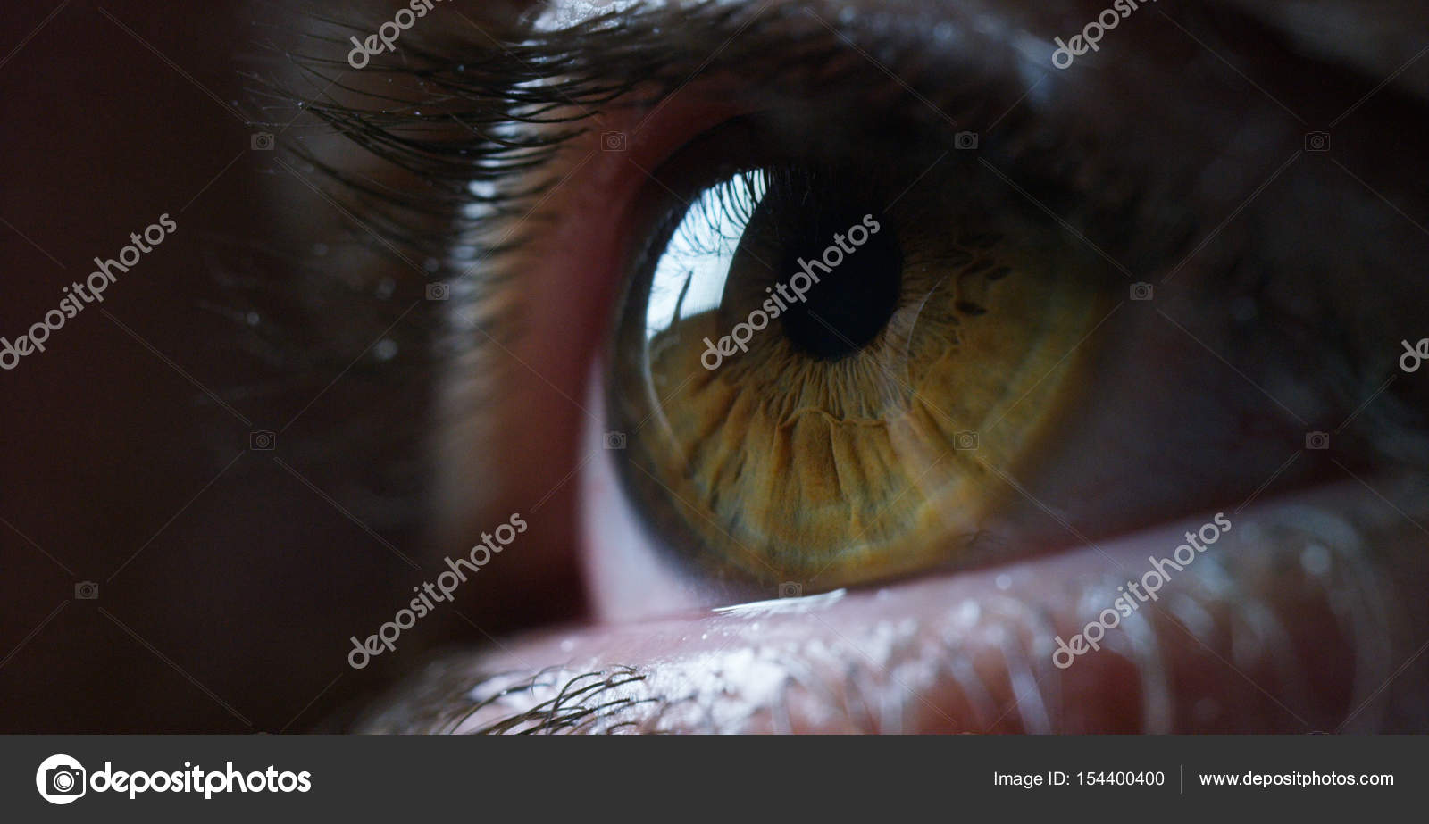Perfect green eye macro in a sterile environment and perfect vision in ...