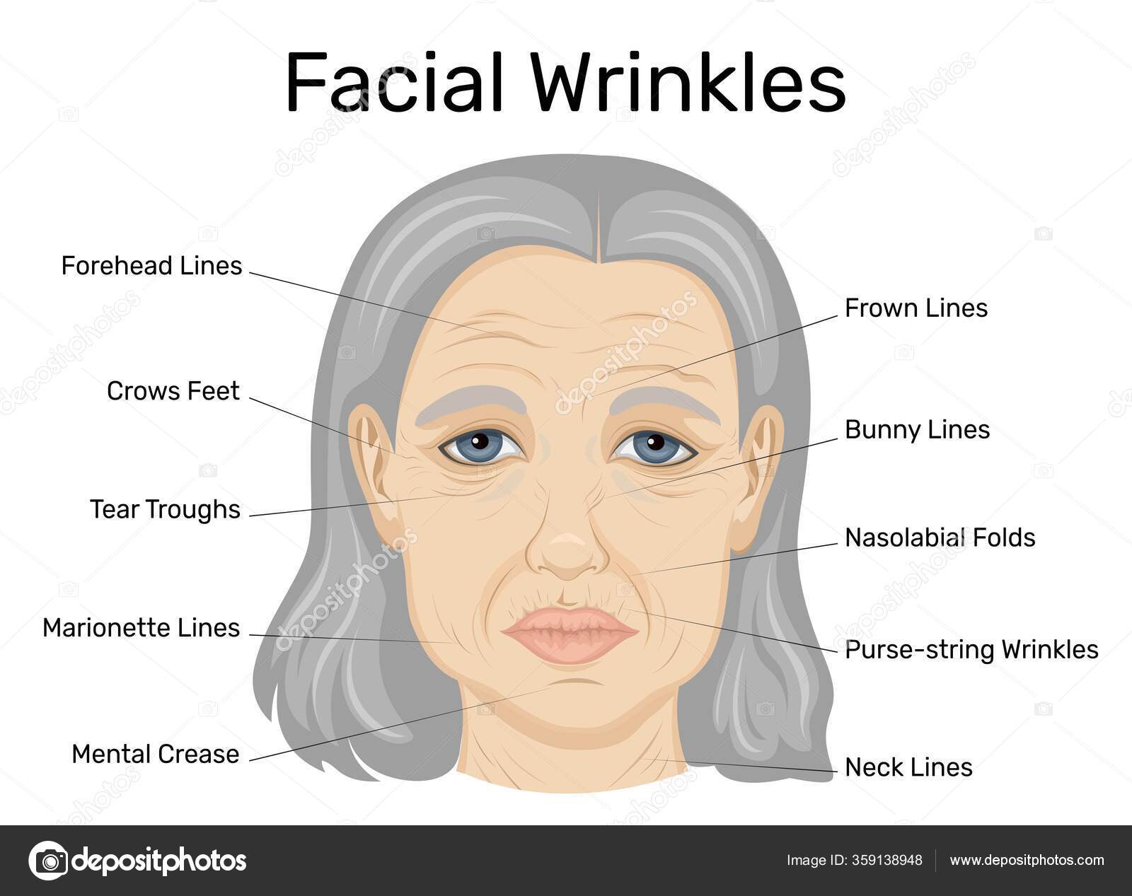 Illustration Types Wrinkles Face Old Woman Stock Vector Image by ...