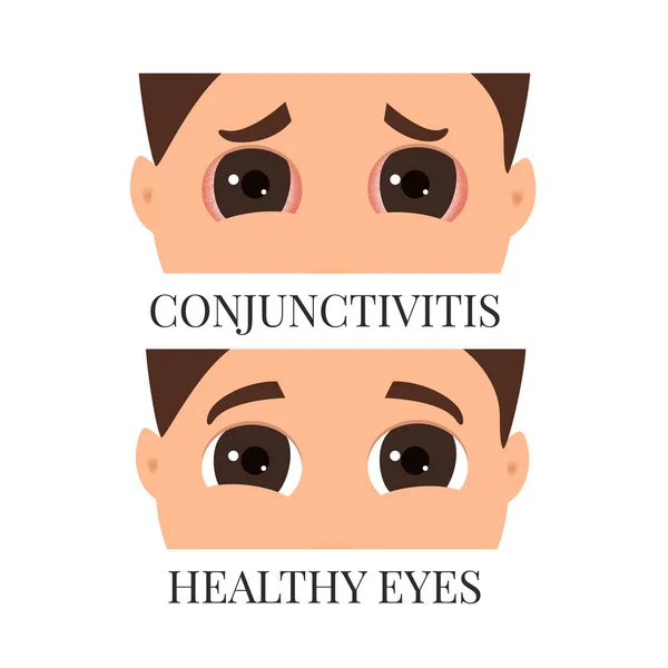 Conjunctiva Vector Art Stock Images | Depositphotos