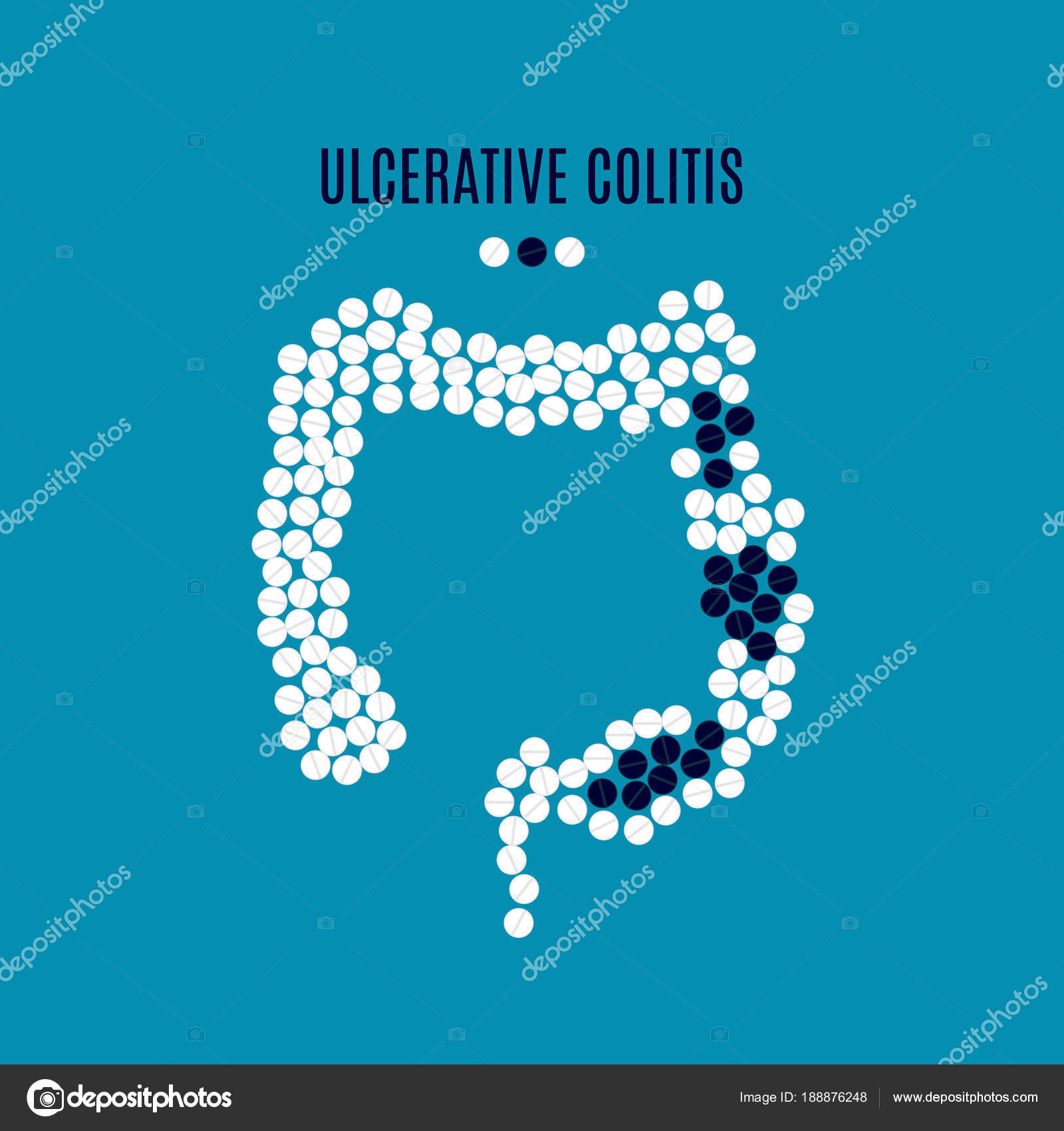Cartel de píldoras de colitis ulcerativa Vector de stock #188876248 de ...