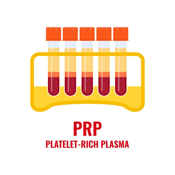 Medical infographics for platelet rich plasma procedure Stock Vector by ...