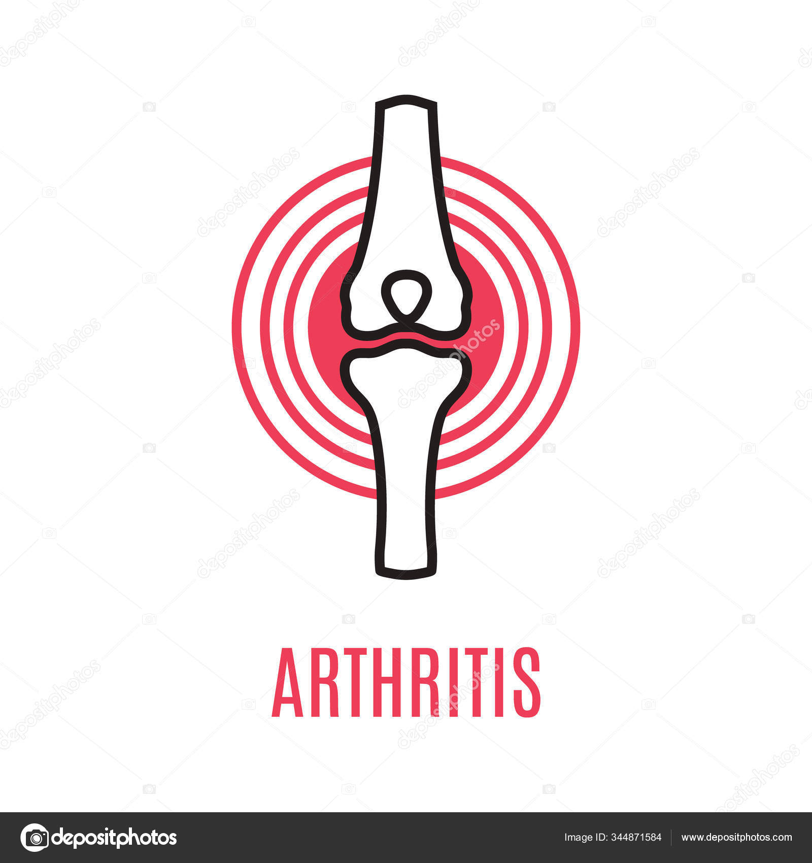 Arthritis disease awareness poster with a knee joint icon Stock Vector ...