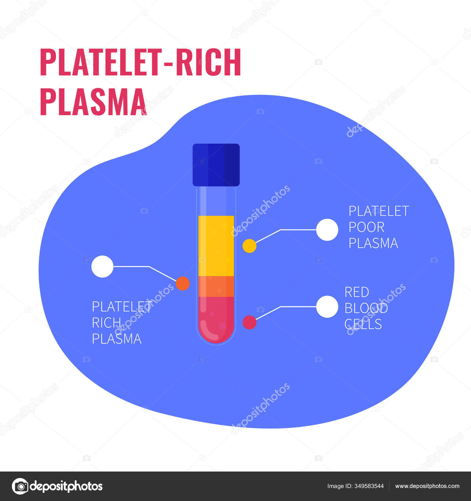 Platelet rich plasma composition infographic medical poster Stock ...