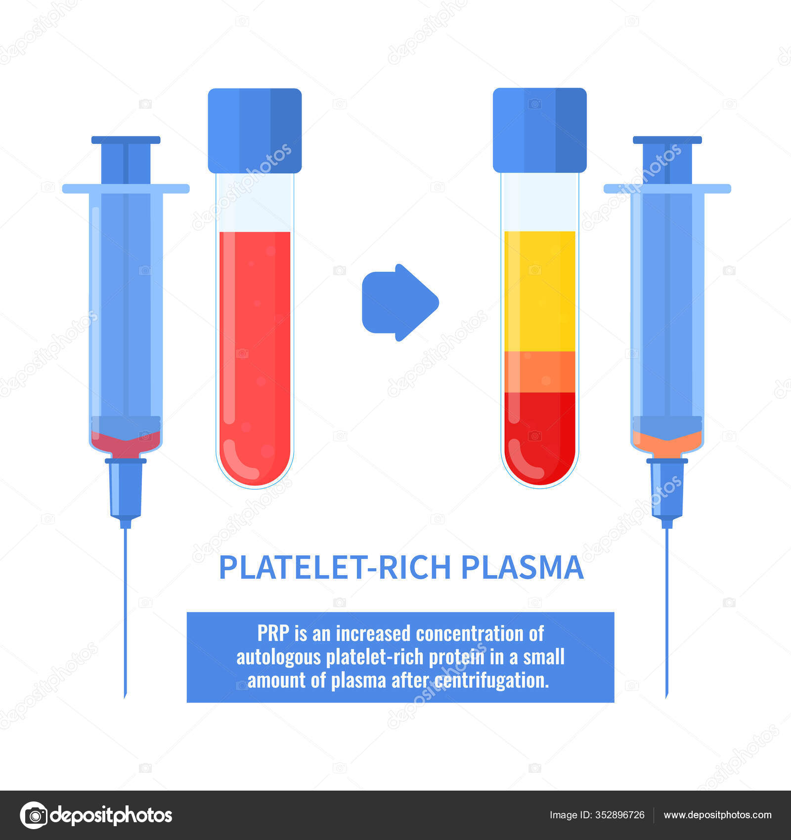 Plaquetas rico en plasma procedimiento de terapia infografías cartel ...