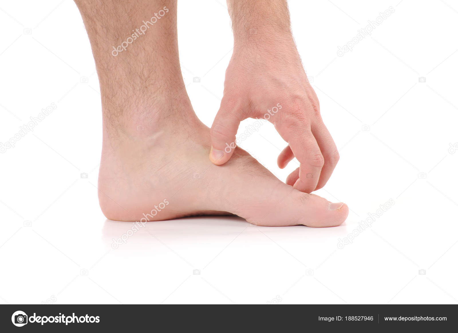 Man scratch the itch with hand. Infection of the feet caused by fungus ...