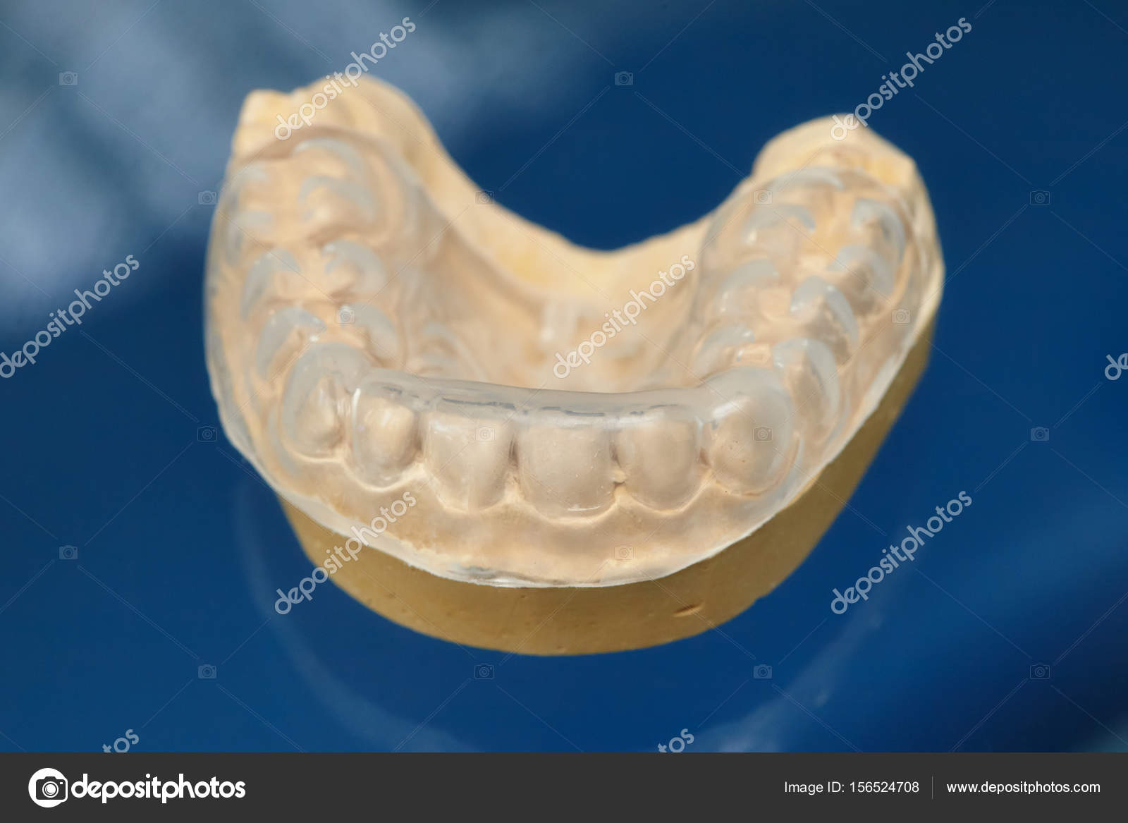 Dental prosthesis teeth mold, clay human gums model — Stock Photo ...