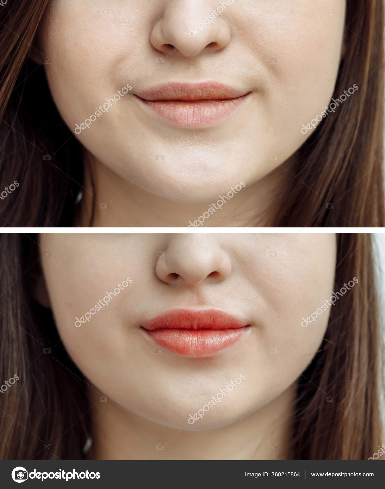 Photo Comparison Permanent Makeup Tattooing Lips Woman Beauty Salon — Stock Photo © hdtexx ...