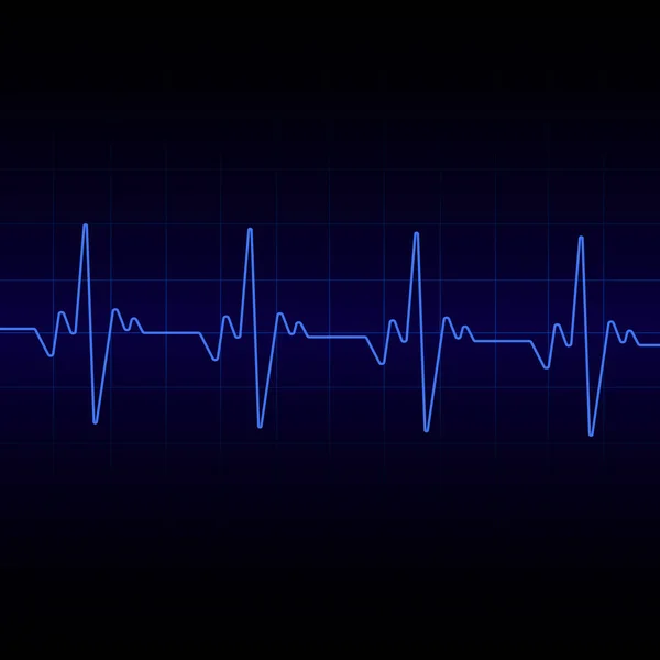 Vector Electrocardiogram Stock Vector Image by ©in8finity #32127211