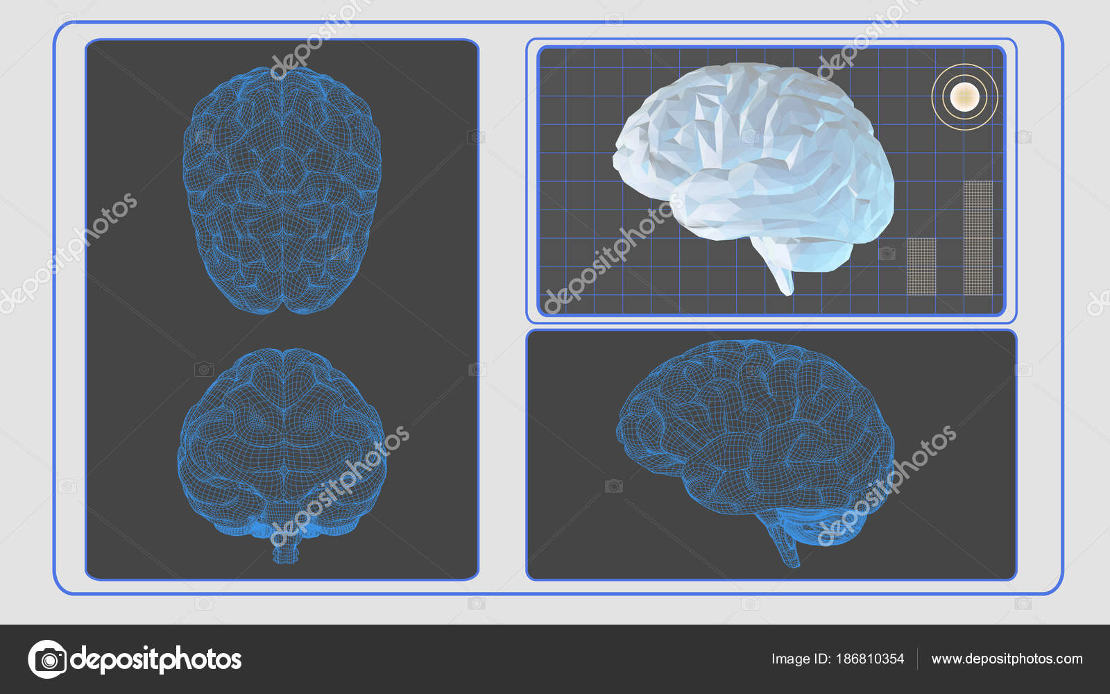 3D brain analysis interface screen on white BG Stock Vector by ©Jolygon ...