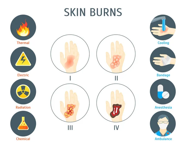 100,000 Burns Vector Images | Depositphotos