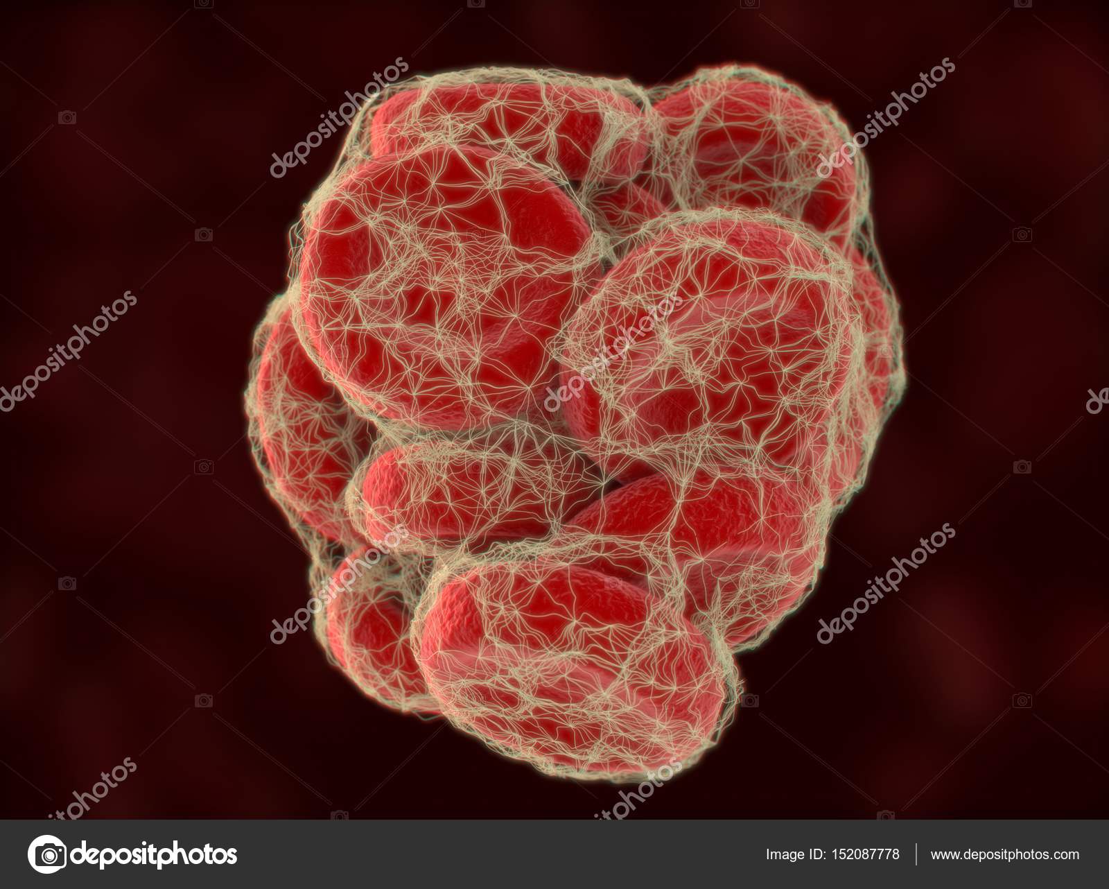 Blood clot model Stock Photo by ©AnatomyInsider 152087778