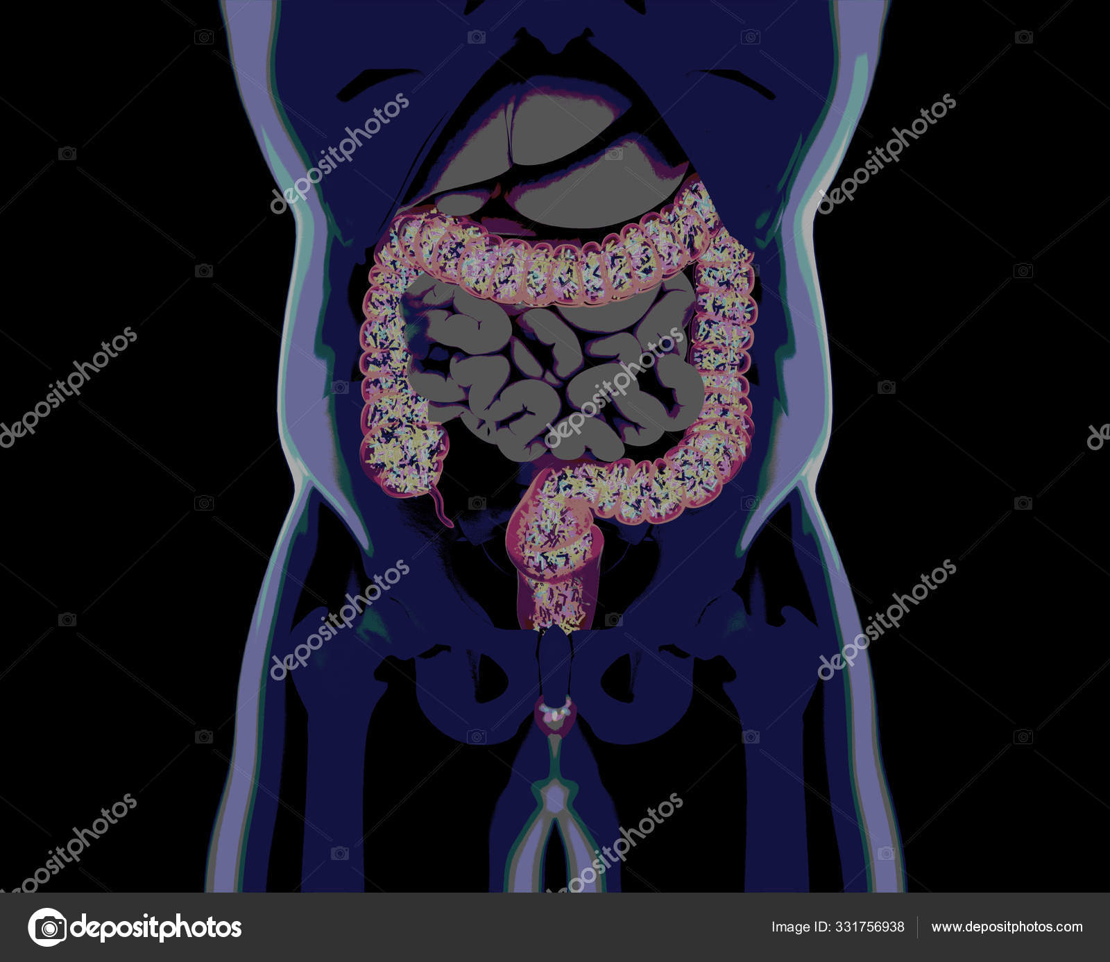 Gut bacteria, microbiome. Bacteria inside the large intestine, c ...