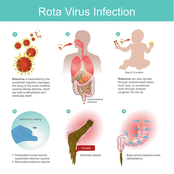 Rotavirus Stock Vectors, Royalty Free Rotavirus Illustrations ...