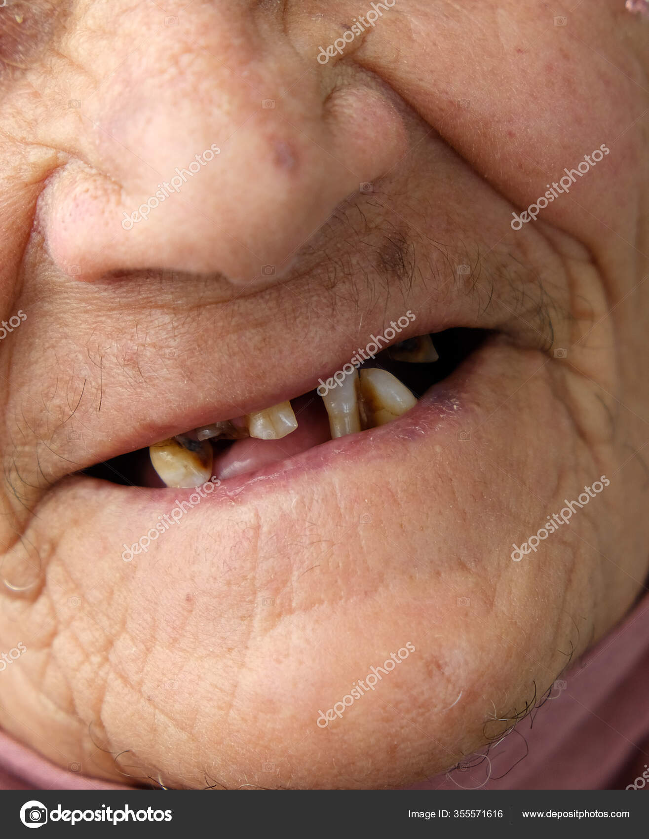 Old Woman Teeth Old Woman Few Teeth Her Mouth — Stock Photo © kodbanker ...