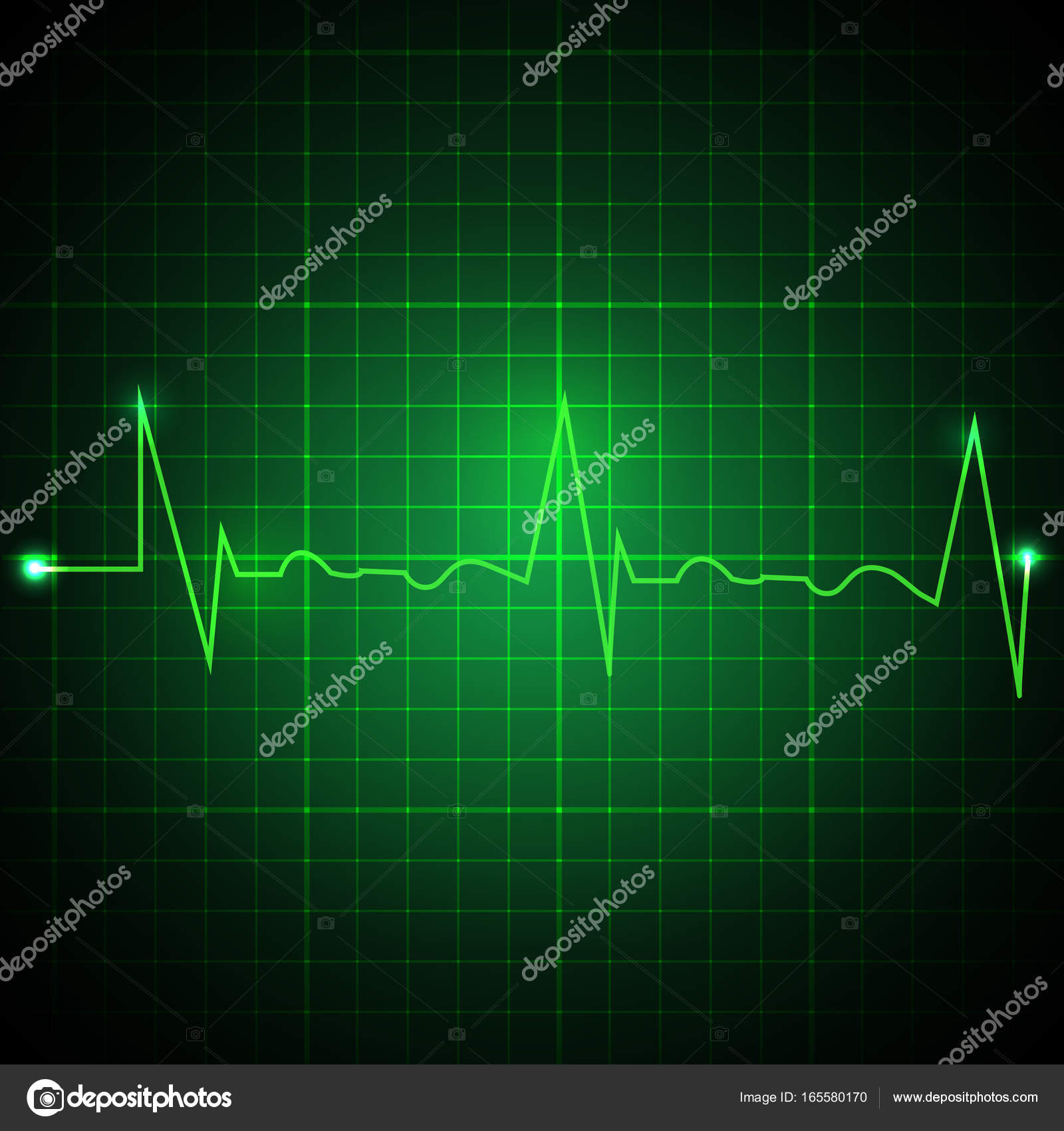 Heart pulse graphic. Ekg line on green background. Cardiogram ...
