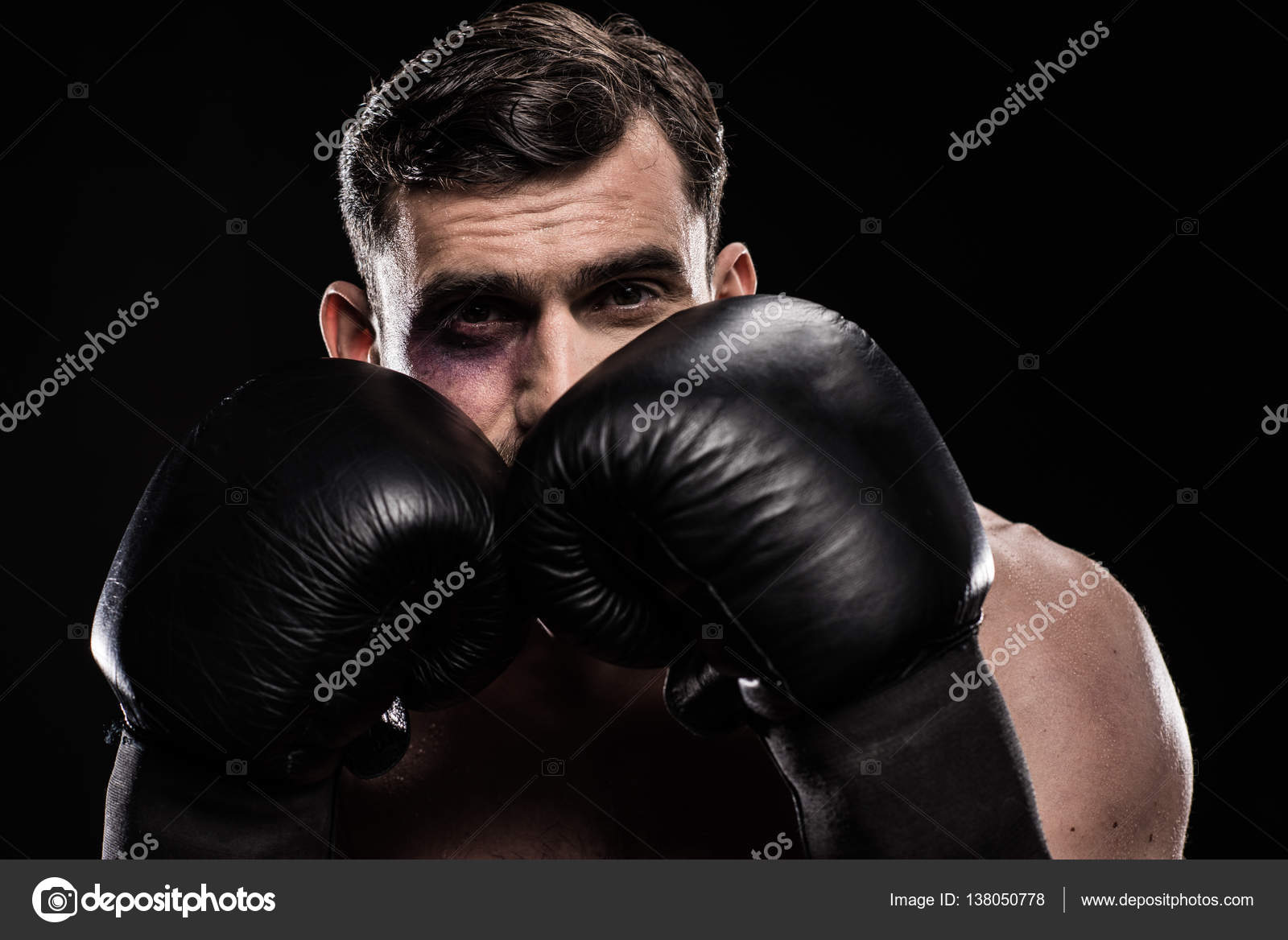 Boxer with black eye — Stock Photo © DmitryPoch #138050778